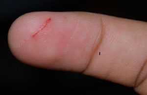 Merbromina: a cosa serve e prezzo