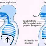 Come far passare il singhiozzo - Idee Green