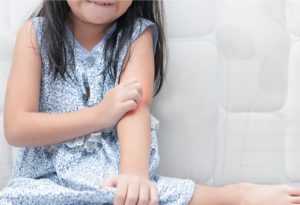 Psoriasi nei bambini, cura e prevenzione